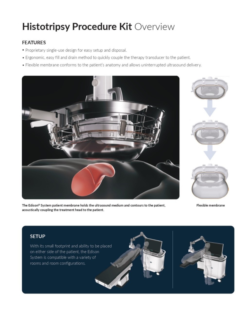 首两名患者一人肿瘤消除，Histotripsy技术可望拓展至儿童癌症 | 星岛环球网