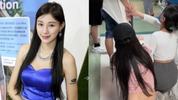 “车模界林志玲”打牛奶针不治，麻醉医师曝业界内幕 | 星岛环球网